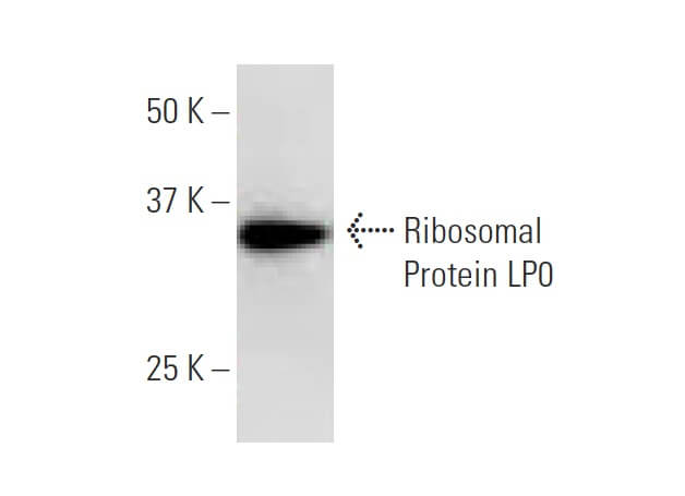Ribosomal Protein LP0 Antibody (1B4) | SCBT - Santa Cruz Biotechnology
