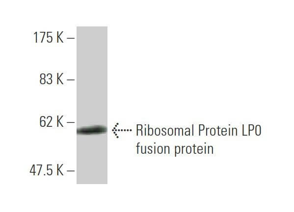 Ribosomal Protein LP0 Antibody (1B4) | SCBT - Santa Cruz Biotechnology