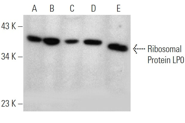 Ribosomal Protein LP0 Antibody (1B4) | SCBT - Santa Cruz Biotechnology