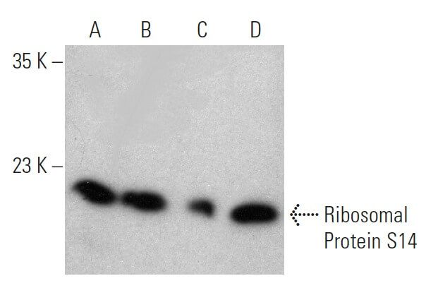 Ribosomal Protein S14抗体 (3G5) | SCBT - Santa Cruz Biotechnology
