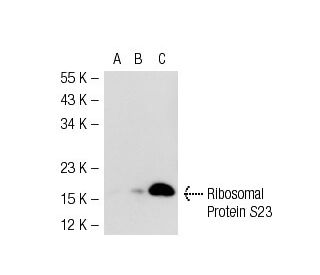 Ribosomal Protein S23 Antibody (SJ-K2) - Western Blotting - Image 52125