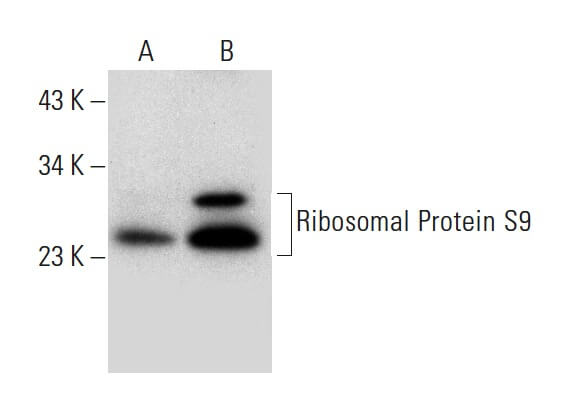 Ribosomal Protein S9 Antibody (E-3) | SCBT - Santa Cruz Biotechnology