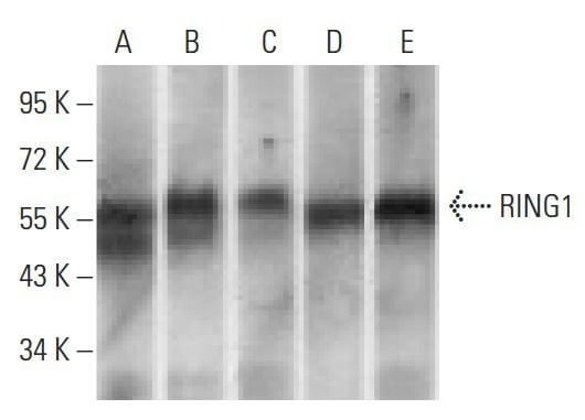 RING1 Antibody (8C12F4) | SCBT - Santa Cruz Biotechnology