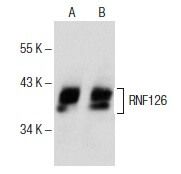 RNF126抗体 (C-1) | SCBT - Santa Cruz Biotechnology