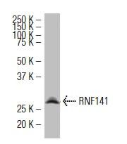 RNF141 Antibody (J-23) | SCBT - Santa Cruz Biotechnology
