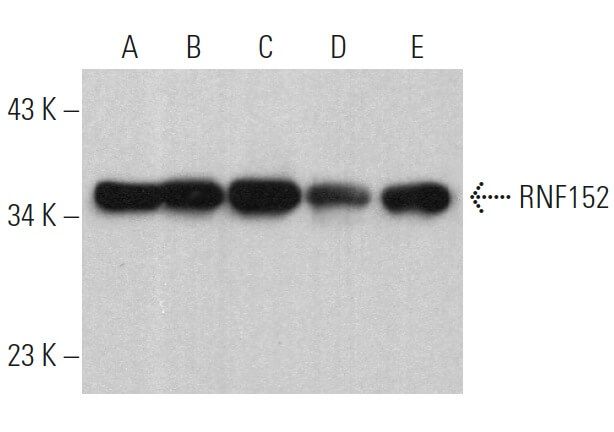 RNF152 Antibody (F-4) | SCBT - Santa Cruz Biotechnology