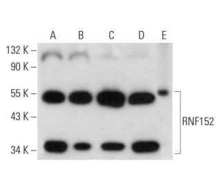 RNF152 Antibody (F-6) | SCBT - Santa Cruz Biotechnology