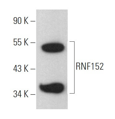 RNF152 Antibody (F-6) | SCBT - Santa Cruz Biotechnology