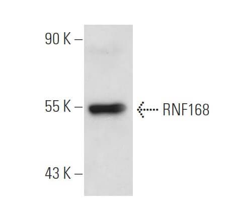RNF168抗体 (B-11) | SCBT - Santa Cruz Biotechnology