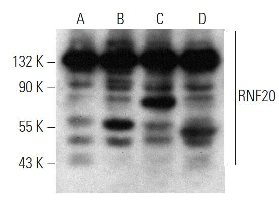 RNF20抗体 (1594CT552.128.36) | SCBT - Santa Cruz Biotechnology