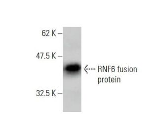 RNF6 Antibody (3B1) | SCBT - Santa Cruz Biotechnology
