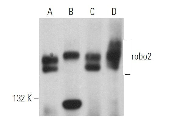 robo2 Antibody (A-10) | SCBT - Santa Cruz Biotechnology