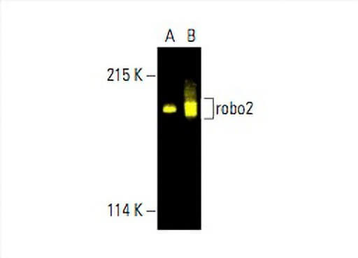 robo2 Antibody (A-10) | SCBT - Santa Cruz Biotechnology