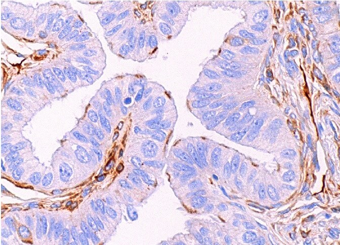 Anti-Rootletin Antibody (C-2) | SCBT - Santa Cruz Biotechnology