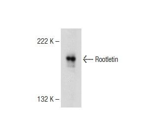 Anti-Rootletin Antibody (C-2) | SCBT - Santa Cruz Biotechnology