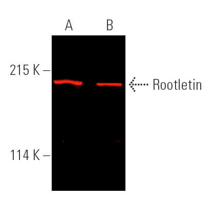 Anti-Rootletin Antibody (C-2) | SCBT - Santa Cruz Biotechnology