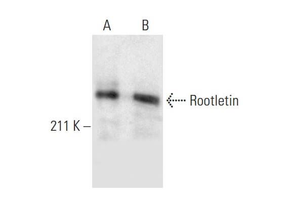 Rootletin Antibody (E-5) | SCBT - Santa Cruz Biotechnology