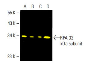 Anti-RPA 32 kDa subunit Antibody (9H8) | SCBT - Santa Cruz Biotechnology