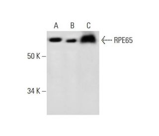 Anti-RPE65 Antibody (E-5) | SCBT - Santa Cruz Biotechnology