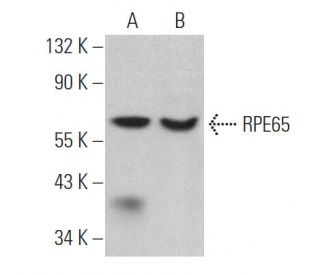 RPE65 Antibody (E-5) - Western Blotting - Image 366500