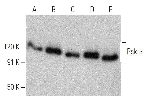 Rsk-3 Antibody (3C4C8) | SCBT - Santa Cruz Biotechnology