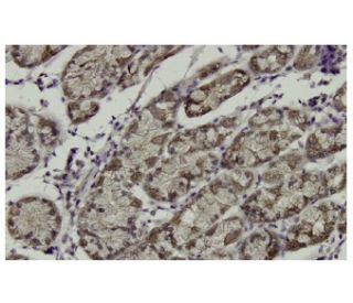 Rsk-4 Antibody (JS-31) | SCBT - Santa Cruz Biotechnology