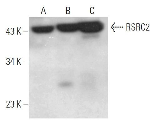 RSRC2 Antibody (D-3) | SCBT - Santa Cruz Biotechnology