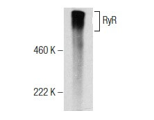 Anti-RyR Antibody (F-1) | SCBT - Santa Cruz Biotechnology