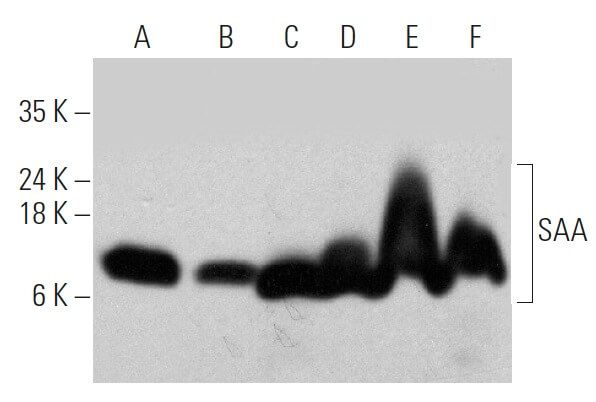 SAA抗体 (115) | SCBT - Santa Cruz Biotechnology