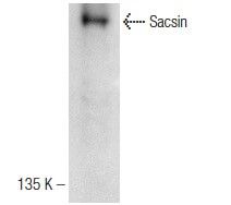 Sacsin Antibody (F-1) | SCBT - Santa Cruz Biotechnology