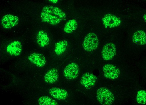 Anti-SAP 155 Antibody (B-3) | SCBT - Santa Cruz Biotechnology