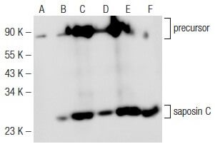 saposin C抗体 (A-3) | SCBT - Santa Cruz Biotechnology