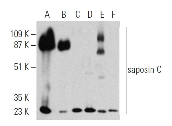 saposin C Antibody (B-10) | SCBT - Santa Cruz Biotechnology