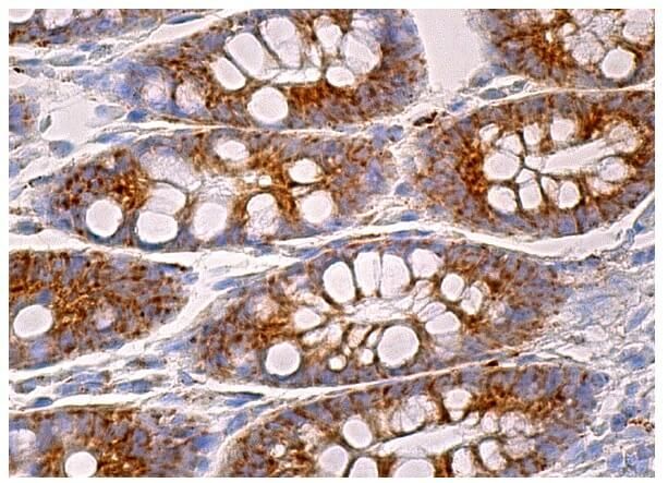 saposin C Antibody (H-81) | SCBT - Santa Cruz Biotechnology