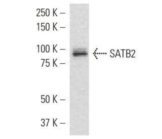 SATB2 Antibody (SATBA4B10) - Western Blotting - Image 16875