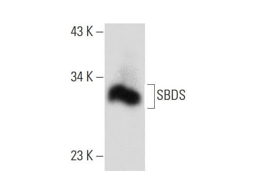 SBDS Antibody (D-6) | SCBT - Santa Cruz Biotechnology