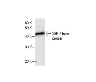 SBP-2 Antibody (2957C2a) | SCBT - Santa Cruz Biotechnology