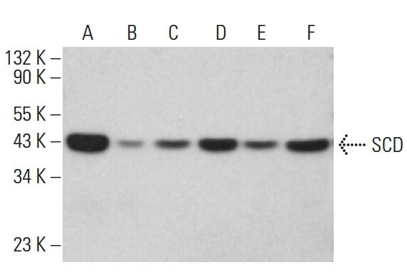 SCD Antibody (D-5) | SCBT - Santa Cruz Biotechnology