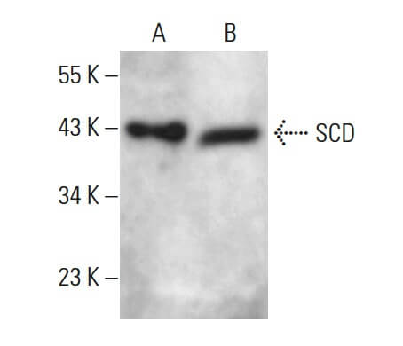 SCD Antibody (D-5) | SCBT - Santa Cruz Biotechnology