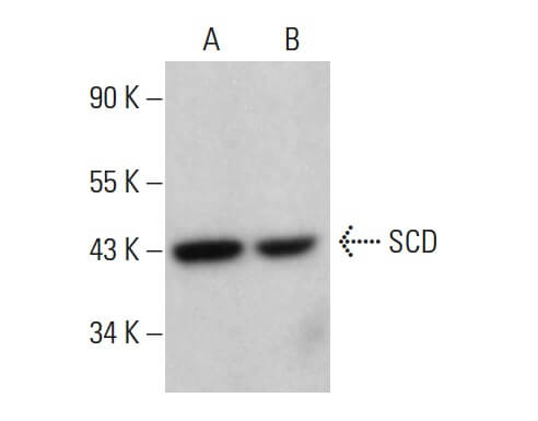 Anti-SCD Antibody (D-5) | SCBT - Santa Cruz Biotechnology