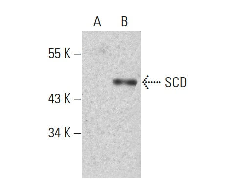 Anti-SCD Antibody (D-5) | SCBT - Santa Cruz Biotechnology
