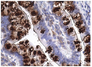 SCF Antibody (G-3) | SCBT - Santa Cruz Biotechnology