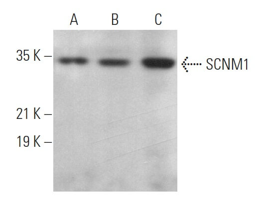 Anti-SCNM1 Antibody (A-6) | SCBT - Santa Cruz Biotechnology