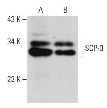 SCP-3抗体 (G-3) | SCBT - Santa Cruz Biotechnology