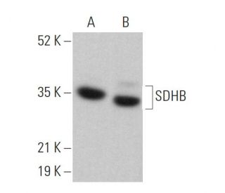 SDHB Antibody (G-10) - Western Blotting - Image 359791
