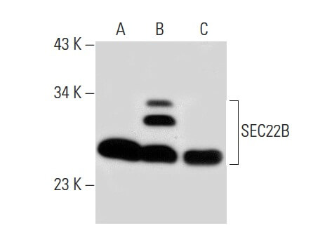 Anti-SEC22B Antibody (29-F7) | SCBT - Santa Cruz Biotechnology