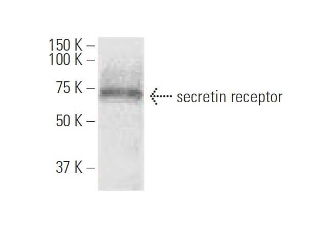 secretin receptor 항체 (3H1) | SCBT - Santa Cruz Biotechnology