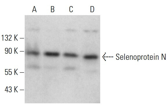 Selenoprotein N Antibody (A-11) | SCBT - Santa Cruz Biotechnology