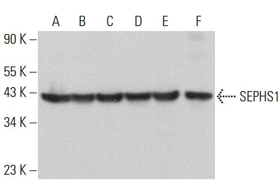 SEPHS1 Antibody (F-6) | SCBT - Santa Cruz Biotechnology