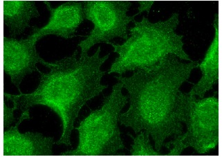 Septin 5 Antibody (E-10) | SCBT - Santa Cruz Biotechnology